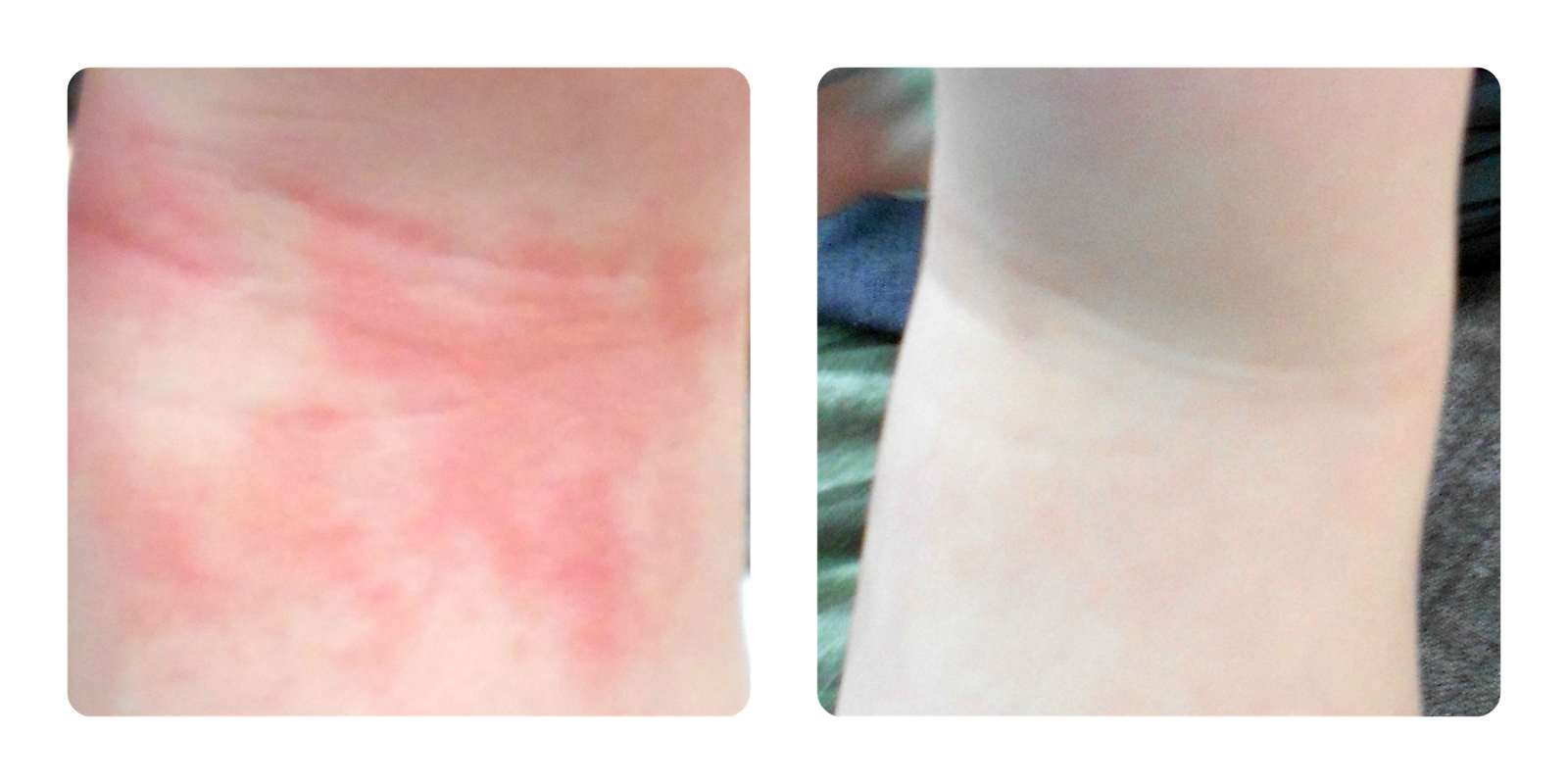 Salcura Bioskin Junior - Testing Time Blog