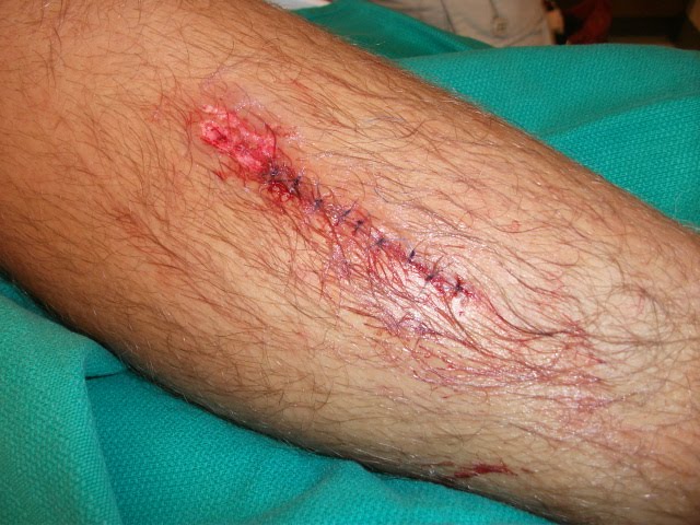 The Next Step: 7 Quick Takes (Volume 191)