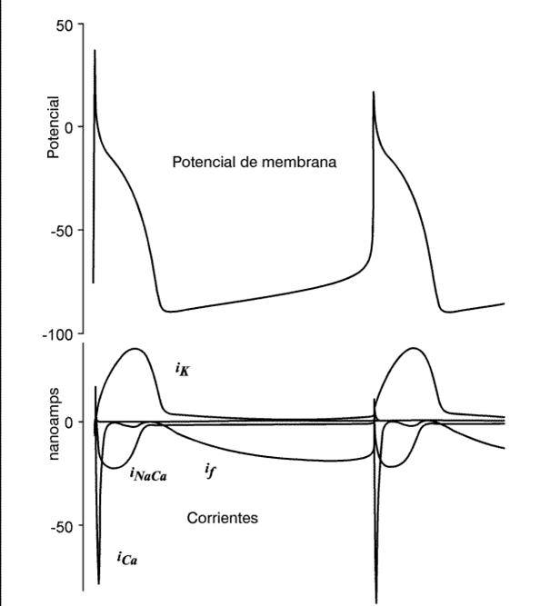 Arritmias cardiacas: Arritmia cardiaca