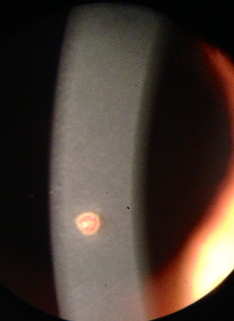 Hardly Housewives: EYE YI YI