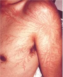 Emergency Medicine: Thunder strom