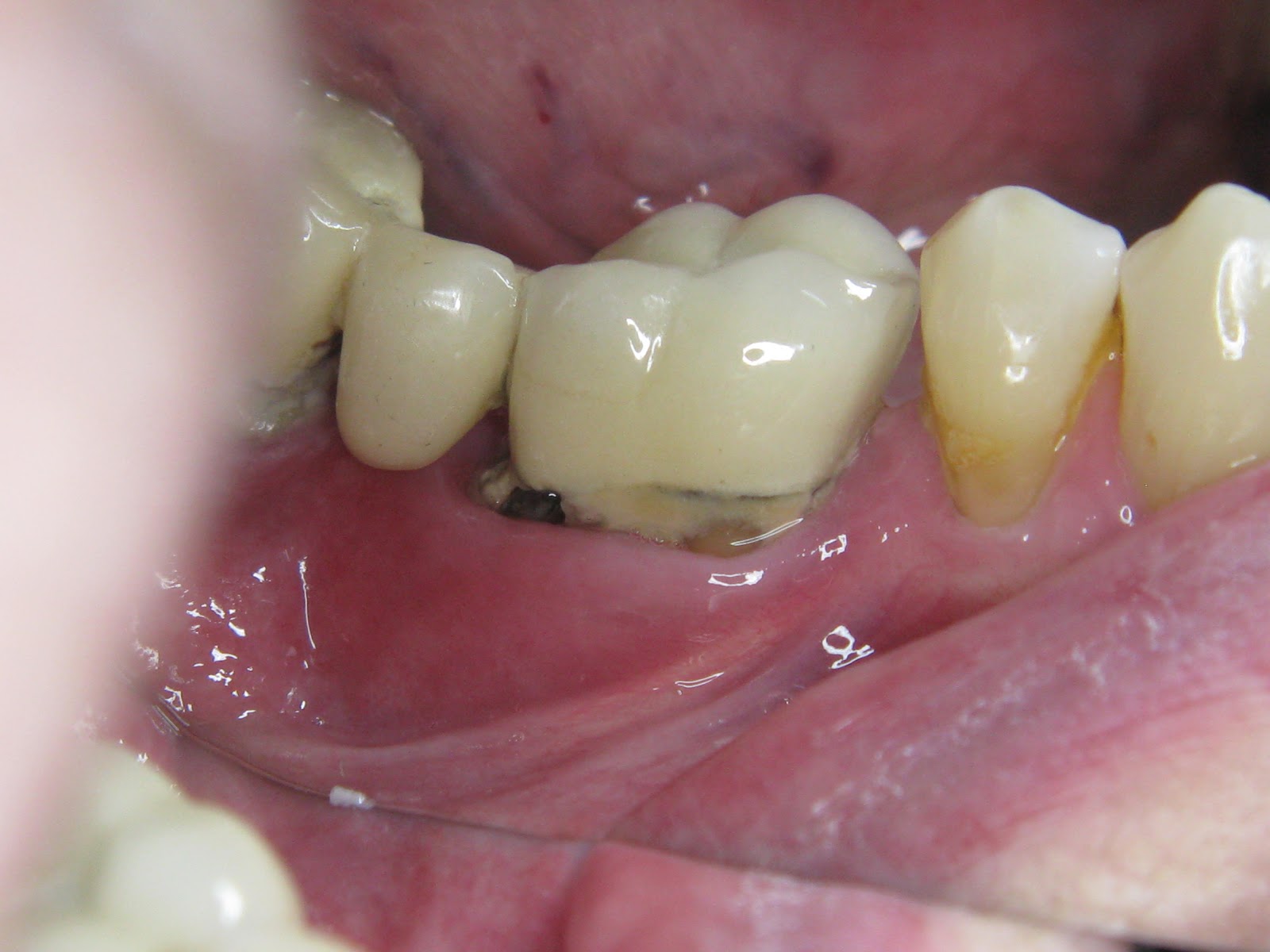 Cases Healozone dental care