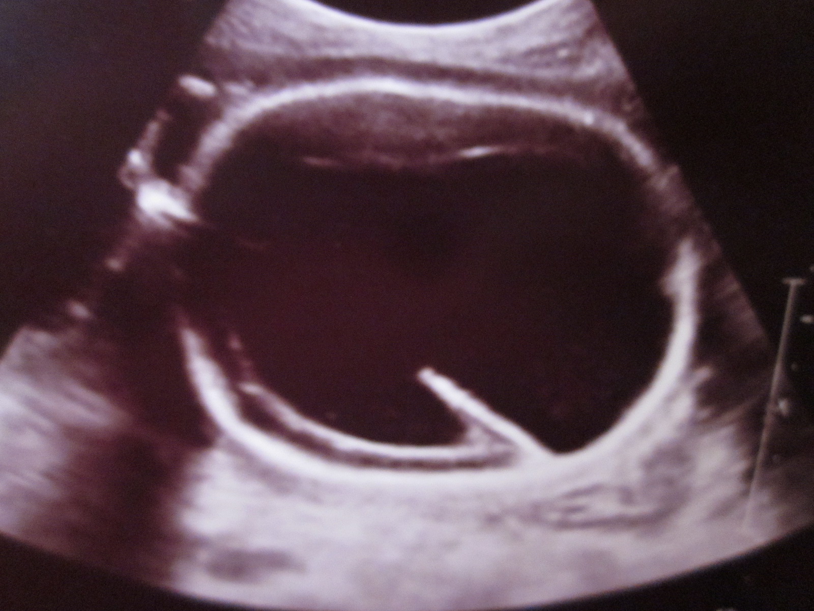Meagan: Photos: 27 week ultrasound