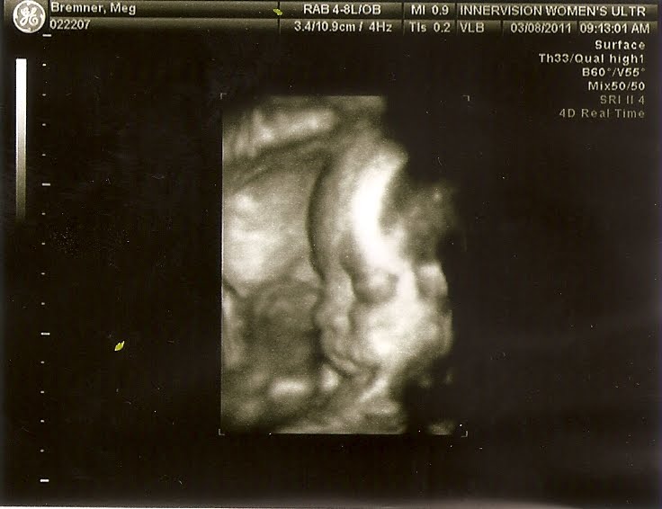 A Simpler Life: 31 week photos, almost 33 weeks pregnant