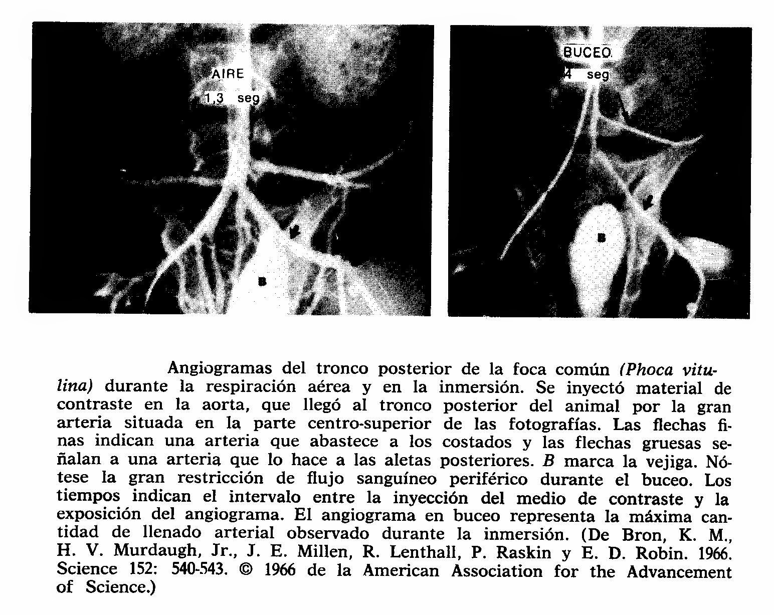 Ecosistema Tierra: HIPERBARISMO