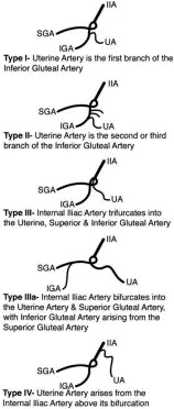 The Pump and the Tubes: The Uterine Artery