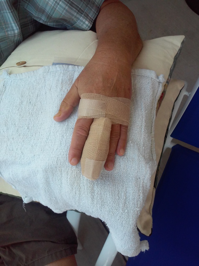 Wayne's World: Craig's crooked finger