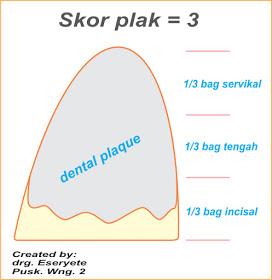 Belajar Cepat Indeks OHI-S