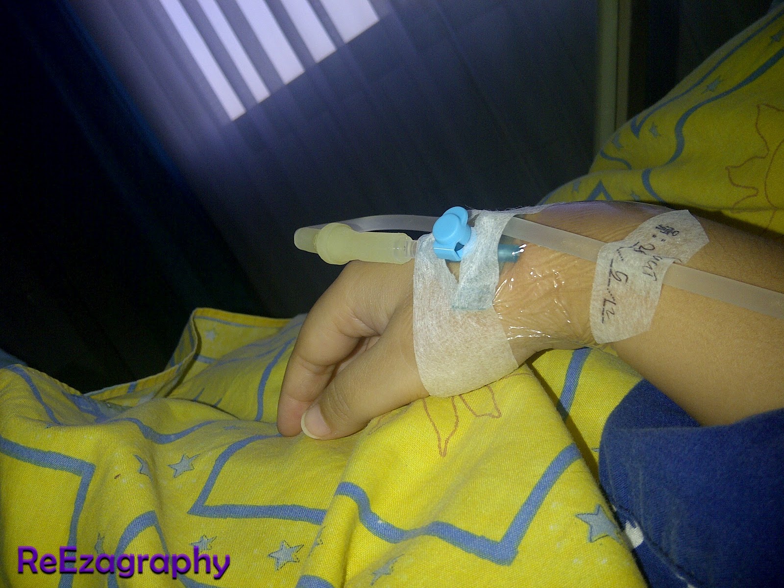 Operasi Usus Buntu - Passion is Love