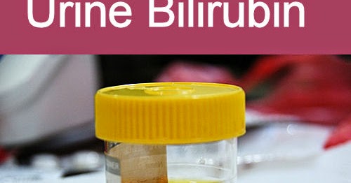 Medical Laboratory and Biomedical Science: Urine Bilirubin