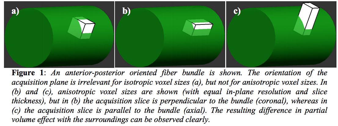 Non-isotropic voxels; What to do and why | Diffusion Imaging; Introduction, tutorials and ...