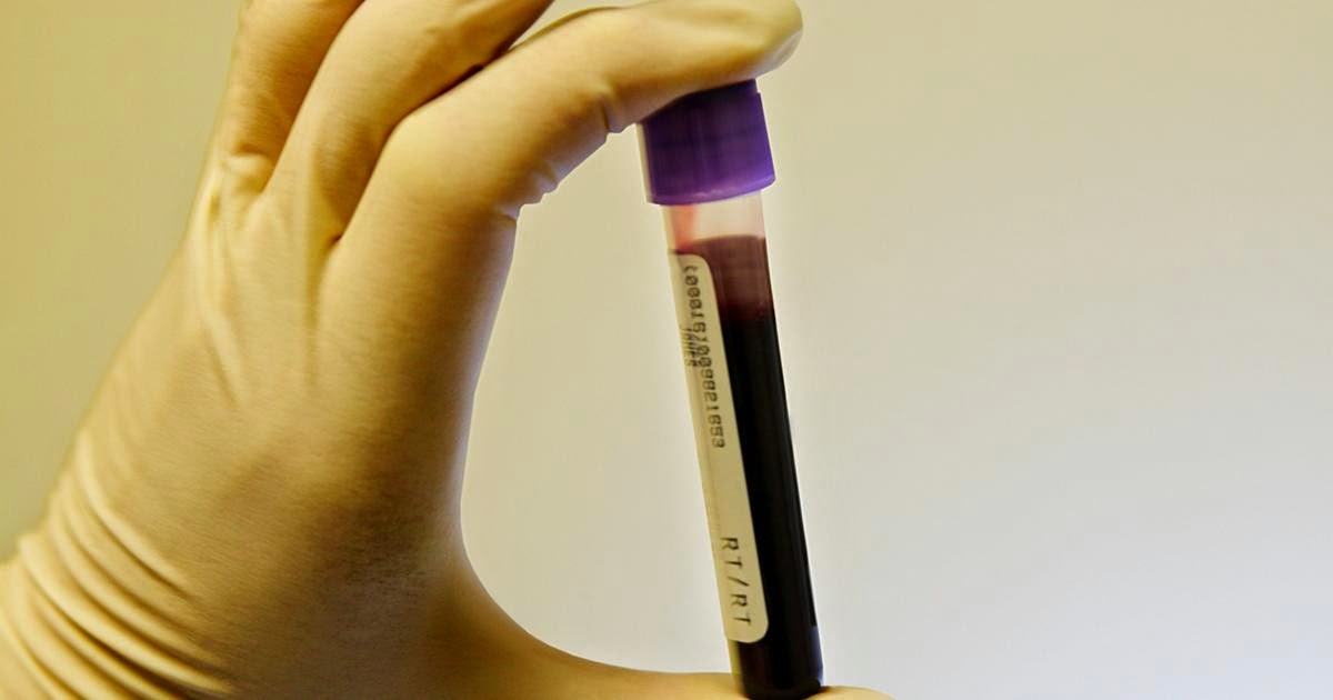 Exame: Gasometria Arterial e os cuidados de enfermagem - Enfermagem