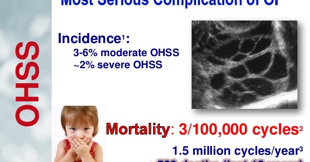 SUSU KAMBING MYMILA: APA ITU OHSS - Ovarian Hyperstimulation Syndrome ...