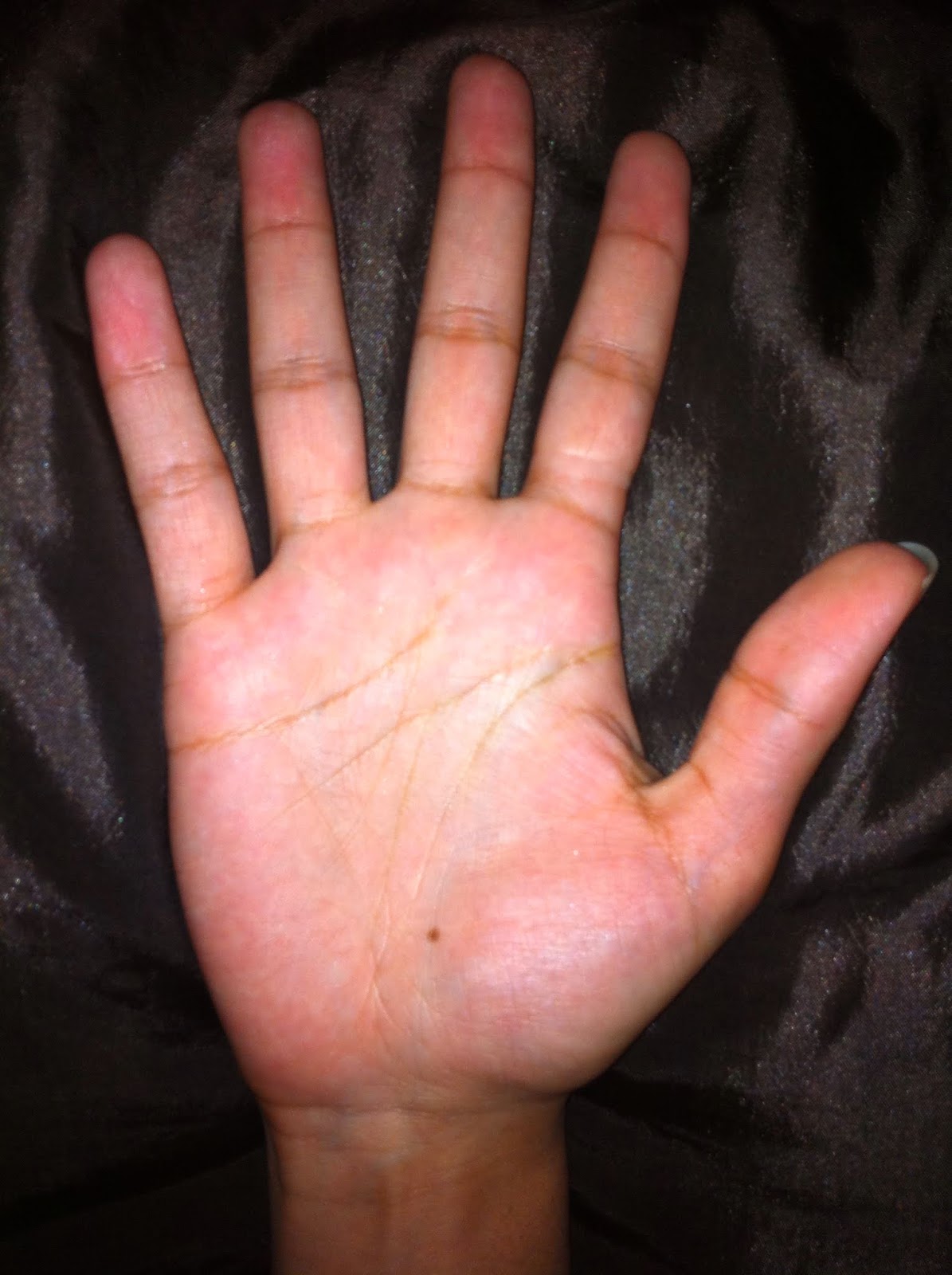 Meaning Of Mole On Venus Mount Palmistry INDIAN PALMISTRY PALM meaning-of-mole-on-venus-mount-palmistry-indian-palmistry-palm