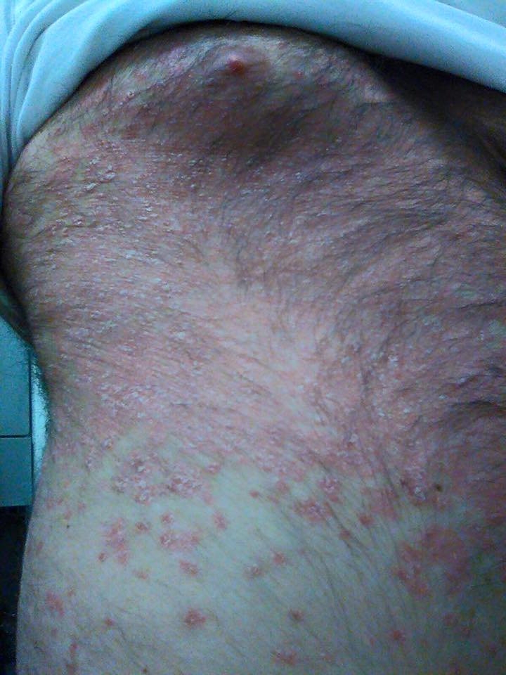 Dermatologo Pisa, Studio Giuseppe Ferrauto : Visite Specialistiche a ...