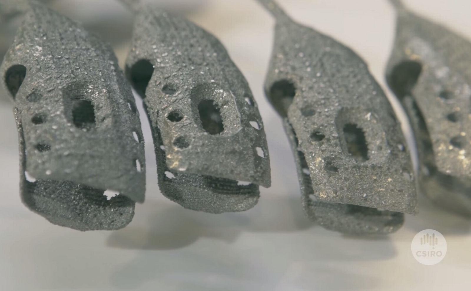 Cancer patient receives world's first 3D printed rib cage in new ...