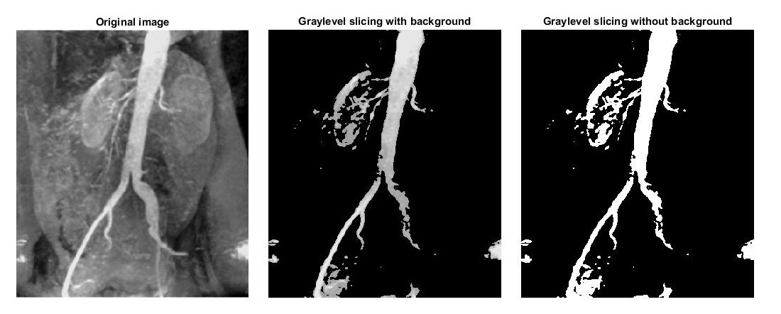 MATLAB Works: Gray Level Slicing in MATLAB