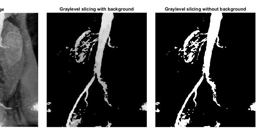 MATLAB Works: Gray Level Slicing in MATLAB