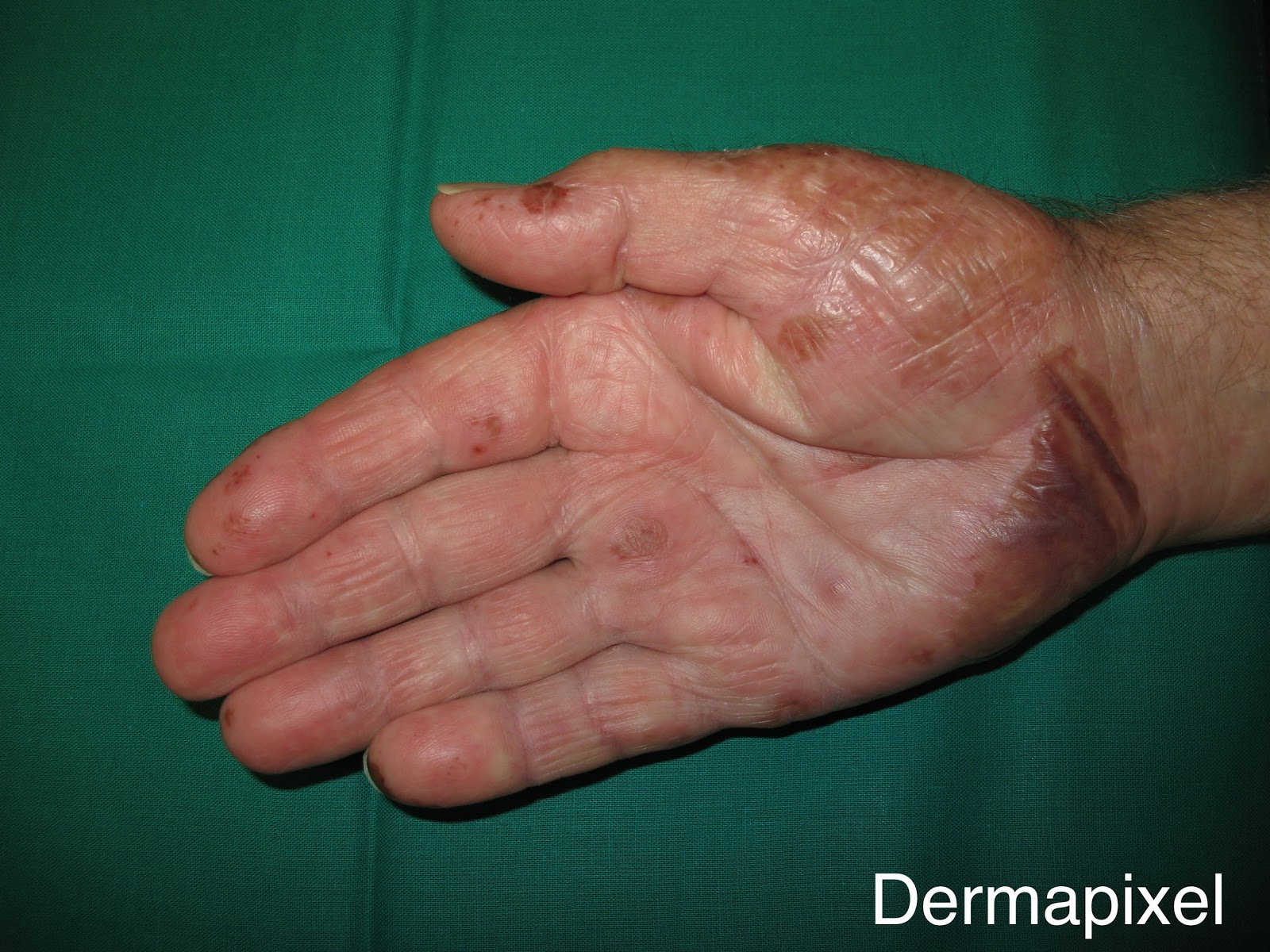 Dermapixel: julio 2018