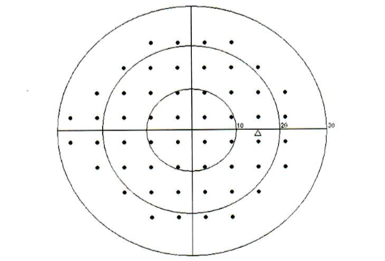 Interpretación Campo visual