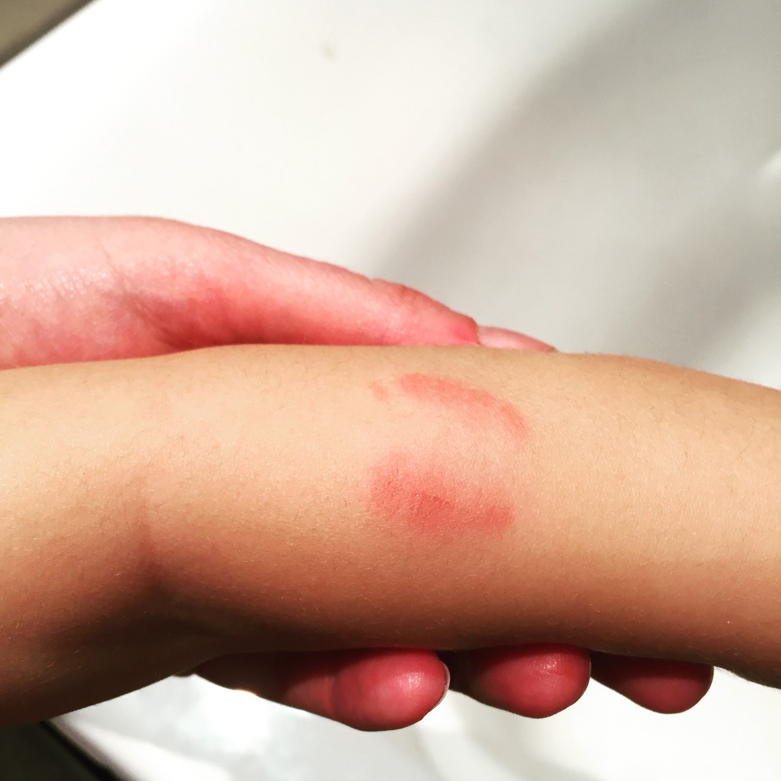 Le blog de Plok: {L'Instant Plok #10} ...Celle qui s'était fait mordre ...