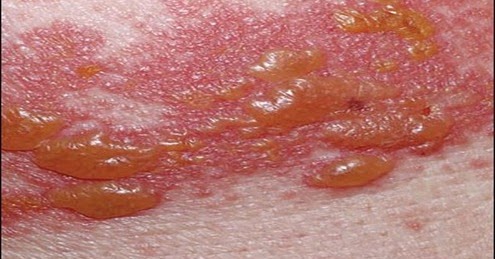 LuvHaryani: Cara Merawat Kayap Ular