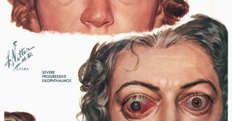 The Medical Illustrations of Dr. Frank Netter