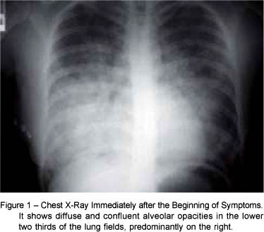 medical: acute transfusion lung injury" ATLI"...