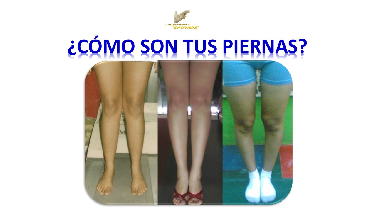 SIN CIRUGÍAS en LÍNEA: ¿CÓMO SON TUS PIERNAS?