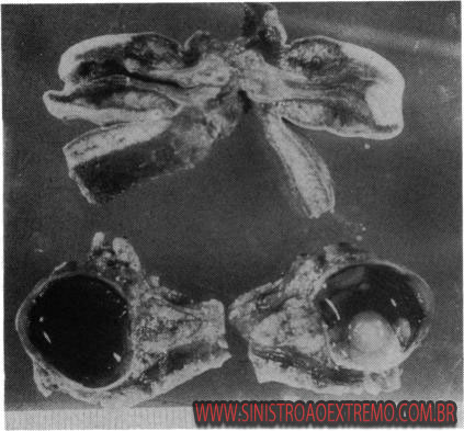 Top 8 mutações humanas - Sinistro ao Extremo