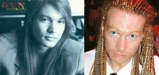 Axl Rose Plastic Surgery Before and After Facelift, Nose Jobs Images