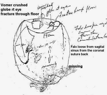 Mark's Super Blog: May 11, 2014