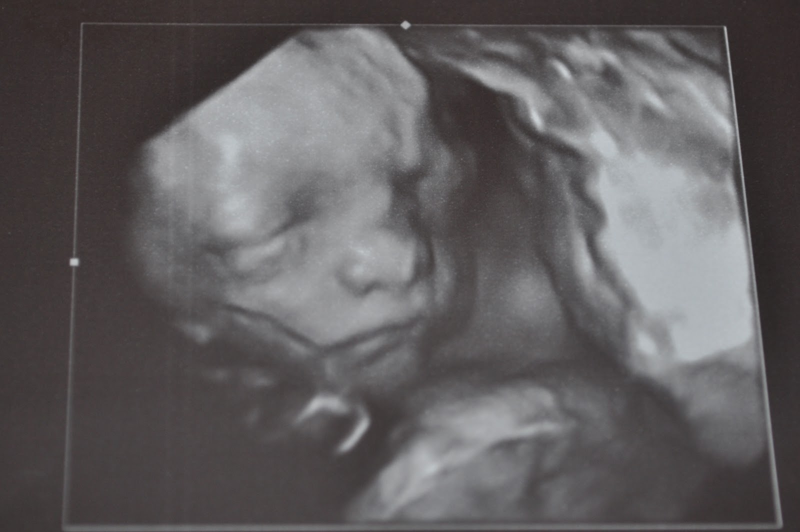 2 Peas in a Pod...: 4-D ultrasound, 24 Weeks