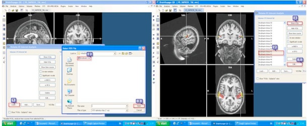 Neuroimaging Made Easy : Brainvoyager QX tips and tricks 1; Some ...