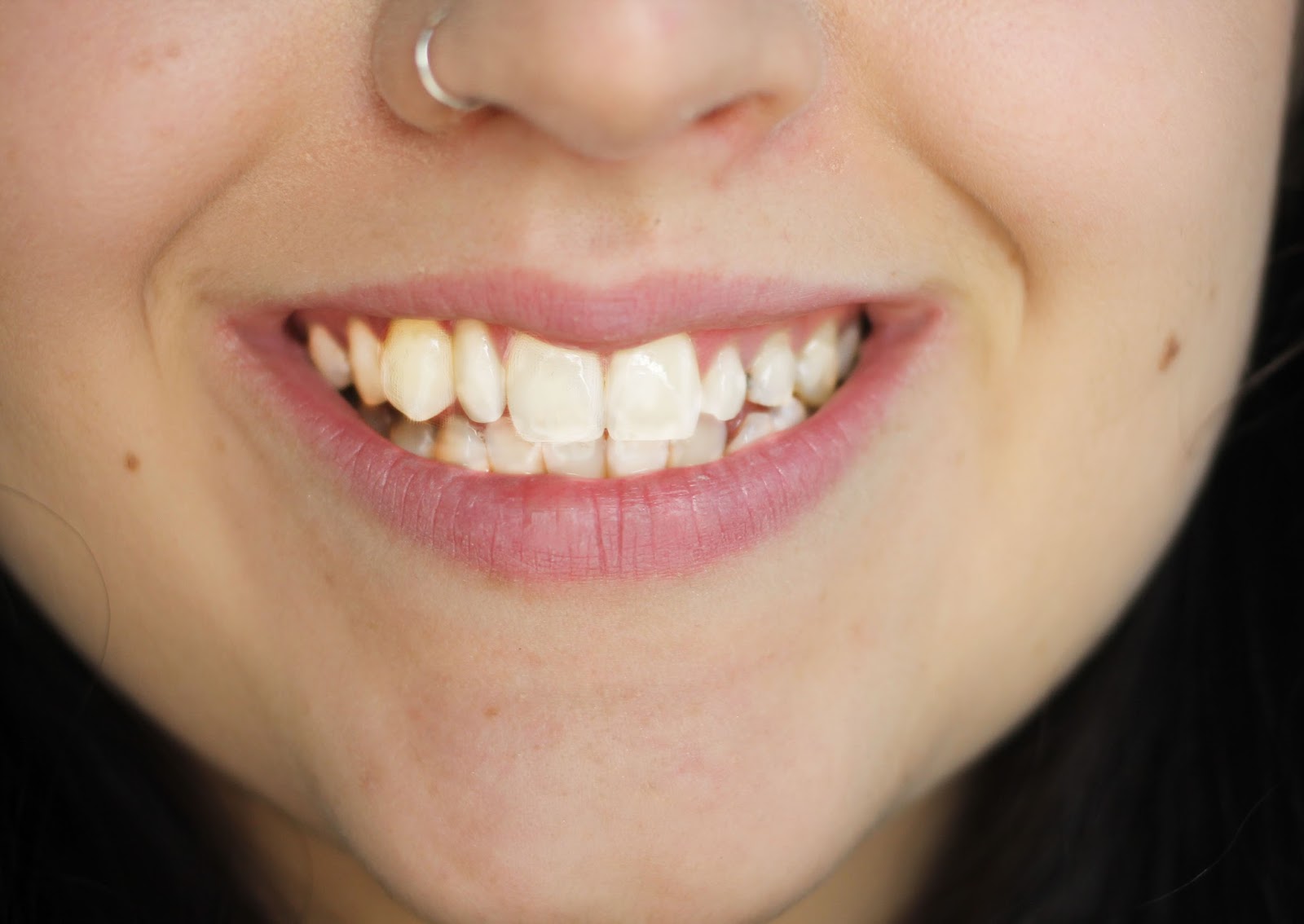 WhiteWash Laboratories: The Road To Whiter Teeth! | Katie Middleton