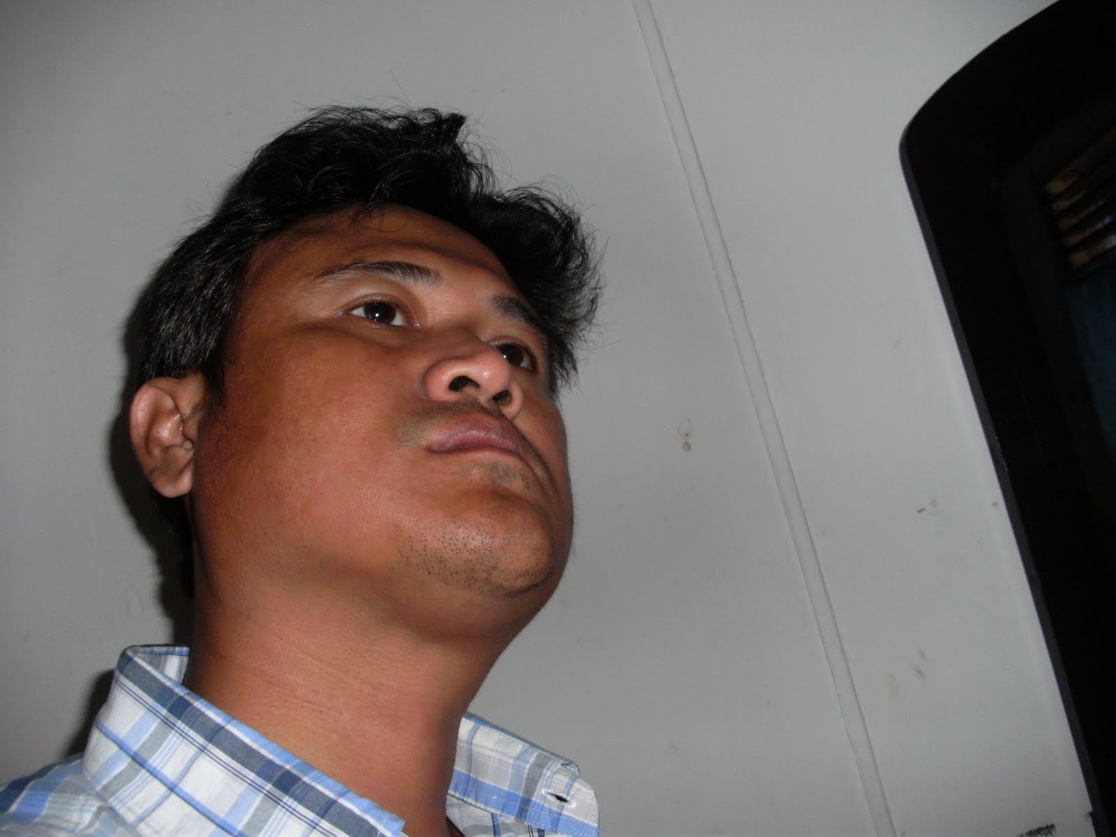 Penyakit Gondongan (Mumps atau Parotitis)