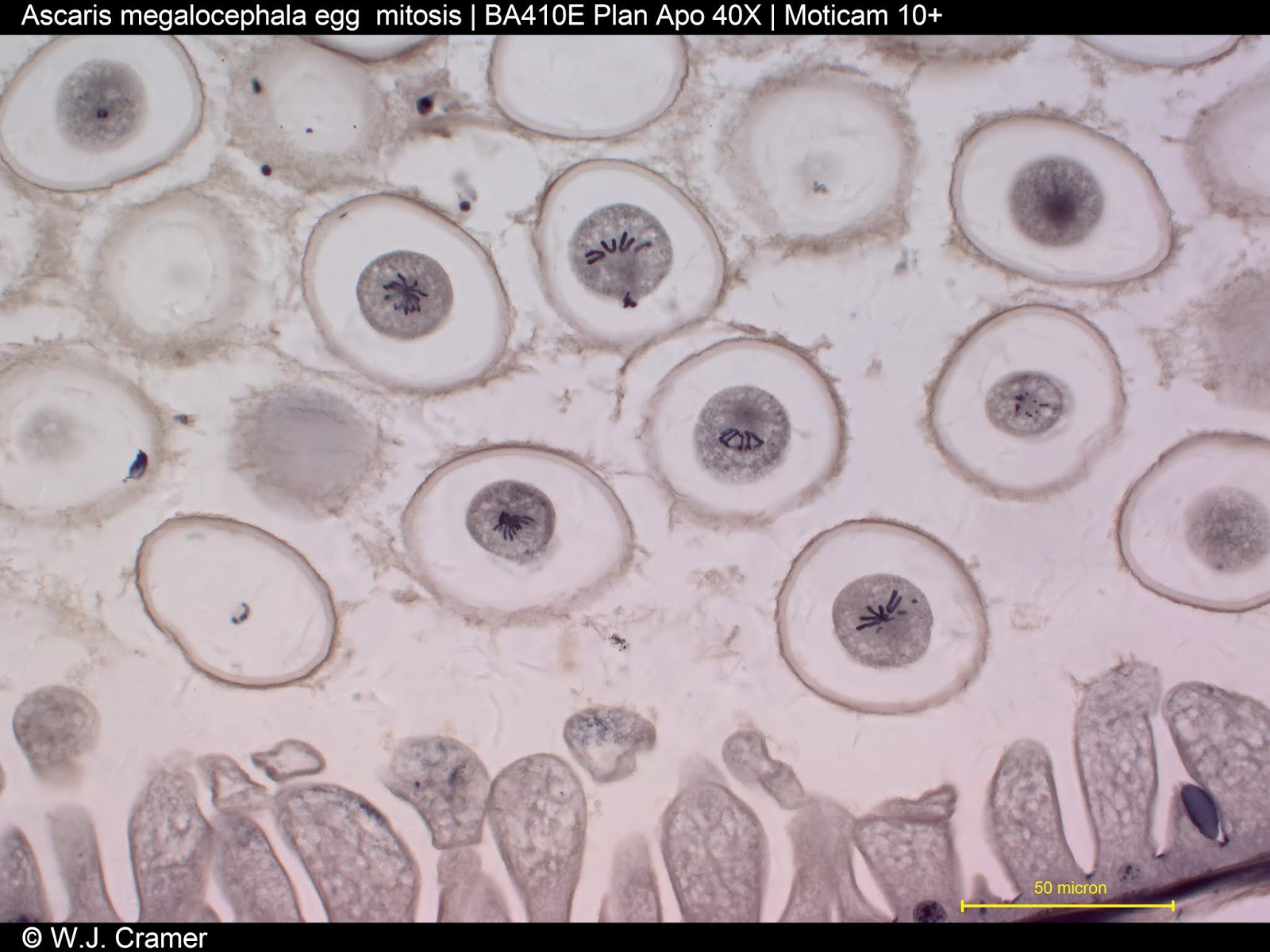 Motic Europe | Blog: How a small intestinal roundworm contributed to ...