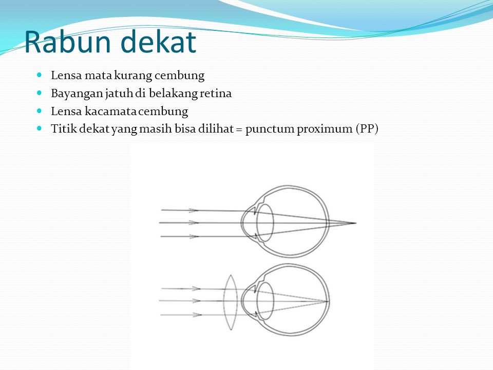 Macam-Macam Gejala Rabun Dekat | Sahabat Rakyat Indonesia