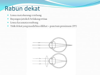 Macam-Macam Gejala Rabun Dekat | Sahabat Rakyat Indonesia