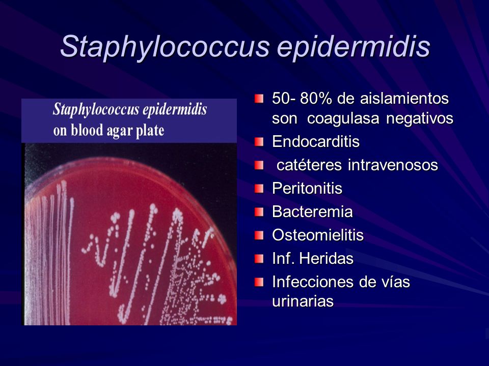 staphylococcus epidermidis