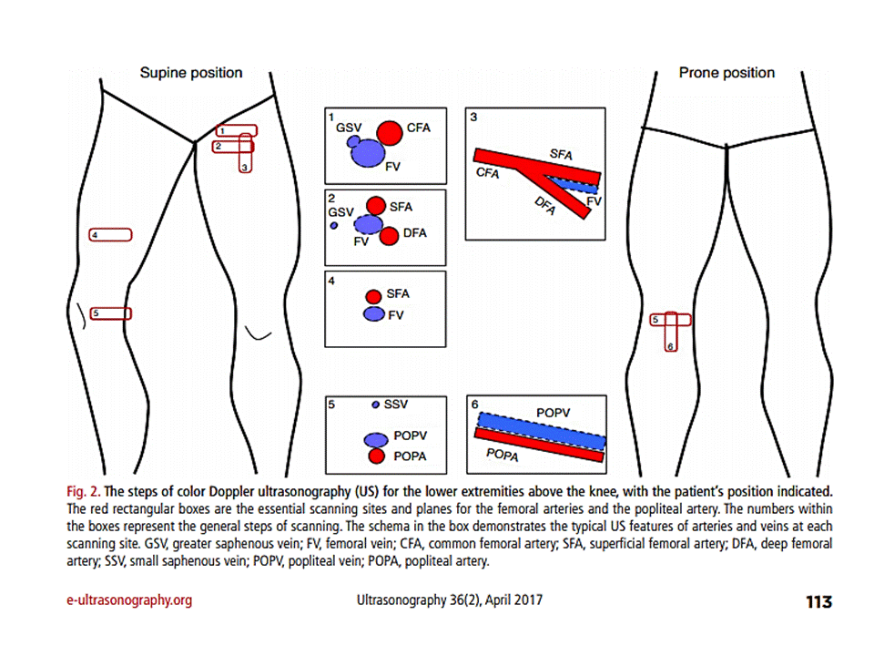 BÀI SOẠN VỀ SIÊU ÂM CHẨN ĐOÁN: Doppler Ultrasonography of the Lower ...