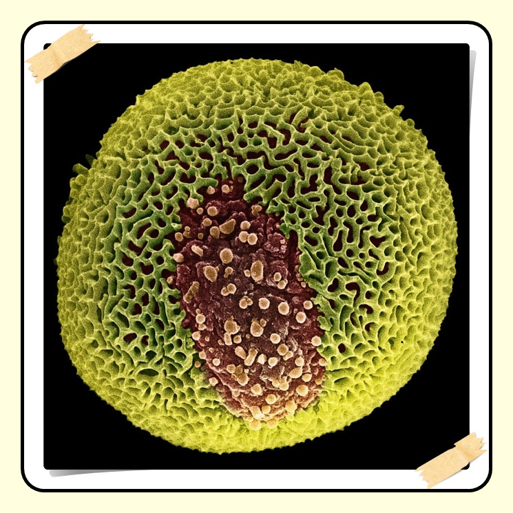 Witty Nity: Pollen Under a Microscope