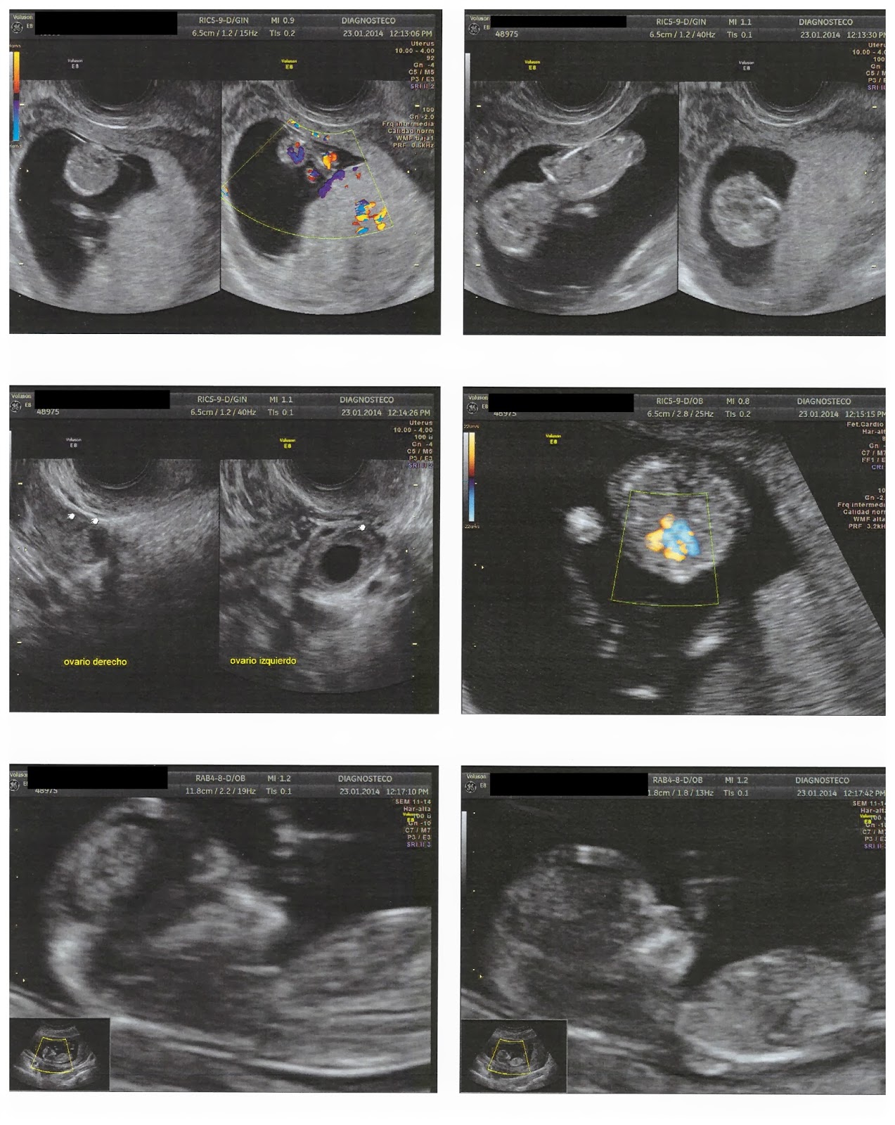 Rural Baby Project: Celia- Eco de las 12 semanas