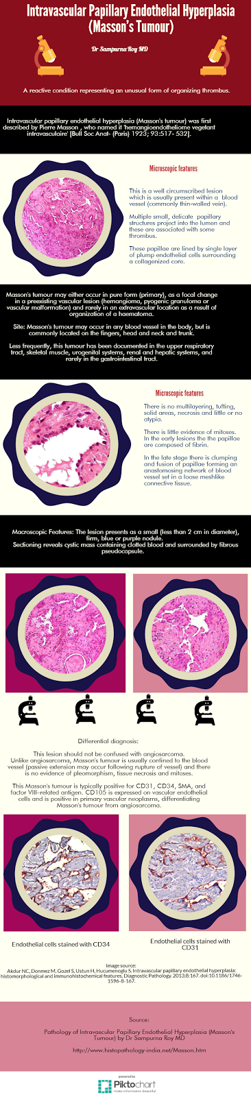 Pathology Infographics