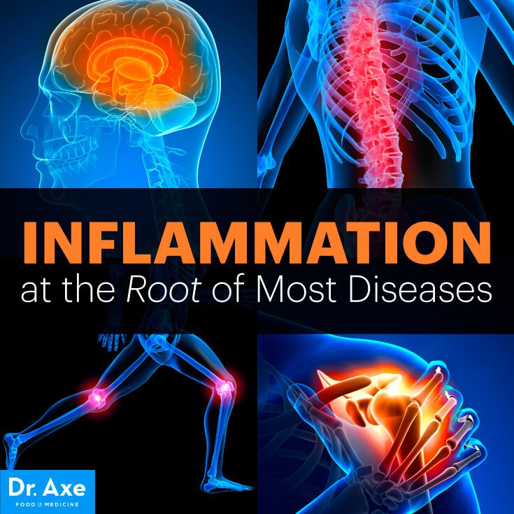 日本 sguardo ad Oriente: About inflammation, body's immune system ...