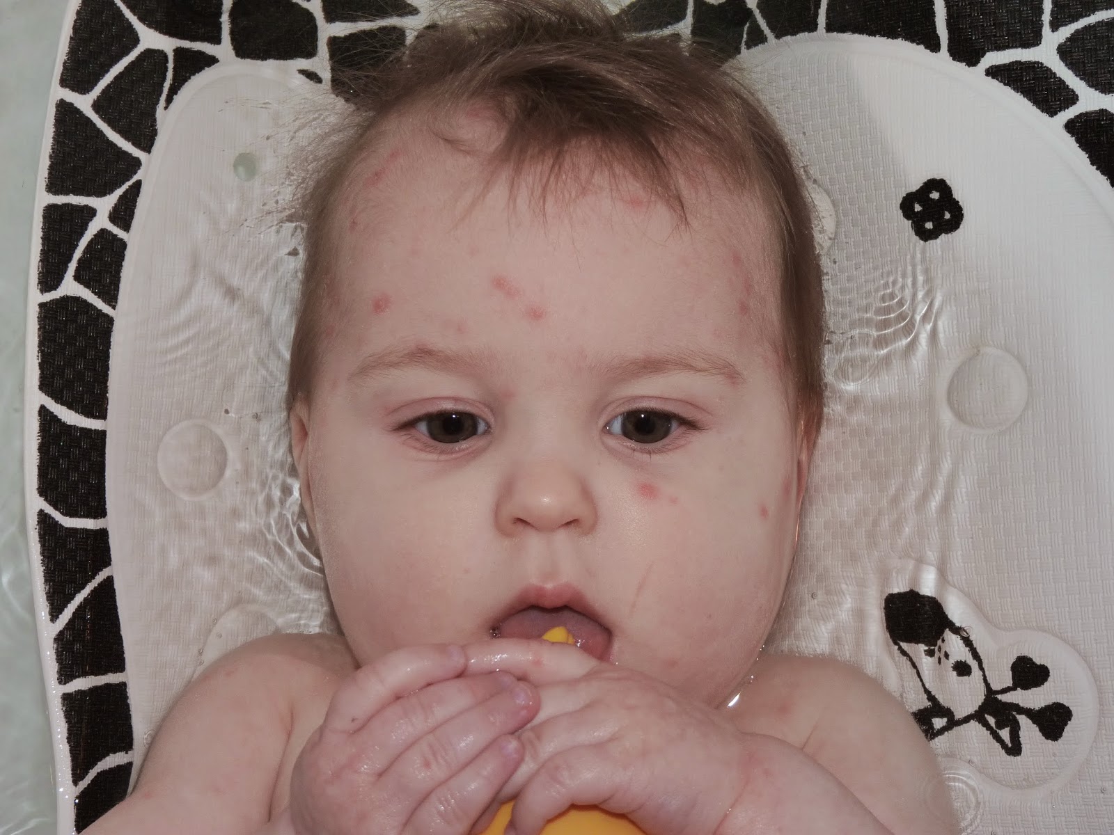 SebMath: La varicelle