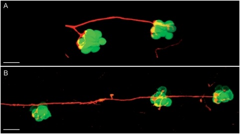 EL DESARROLLO DEL PEZ CEBRA: EL DESARROLLO DE LA LÍNEA LATERAL EN ...