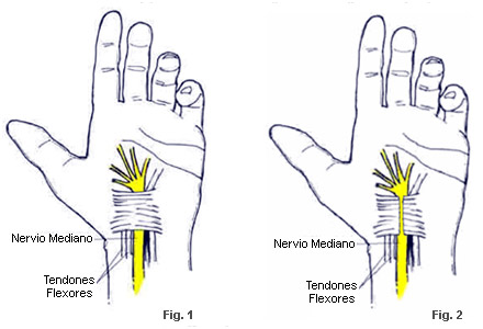 Anatomía Argerich Escuela de instrumentación quirúrgica: junio 2015