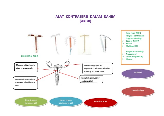 KESEHATAN, MOTIVASI DAN INSPIRASI: ALAT KONTRASEPSI DALAM RAHIM (AKDR) KESEHATAN, MOTIVASI DAN INSPIRASI: ALAT KONTRASEPSI DALAM RAHIM (AKDR)