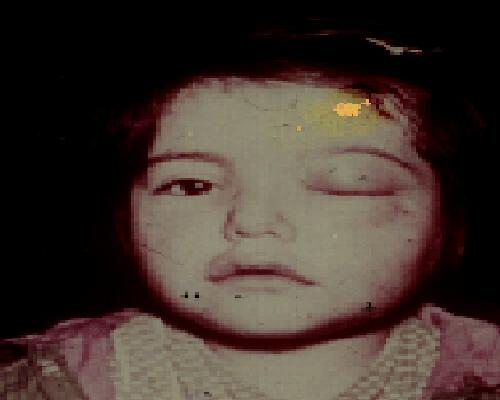 BLOG DO JOEL CALDAS: NOÇÕES BÁSICAS SOBRE DOENÇA DE CHAGAS